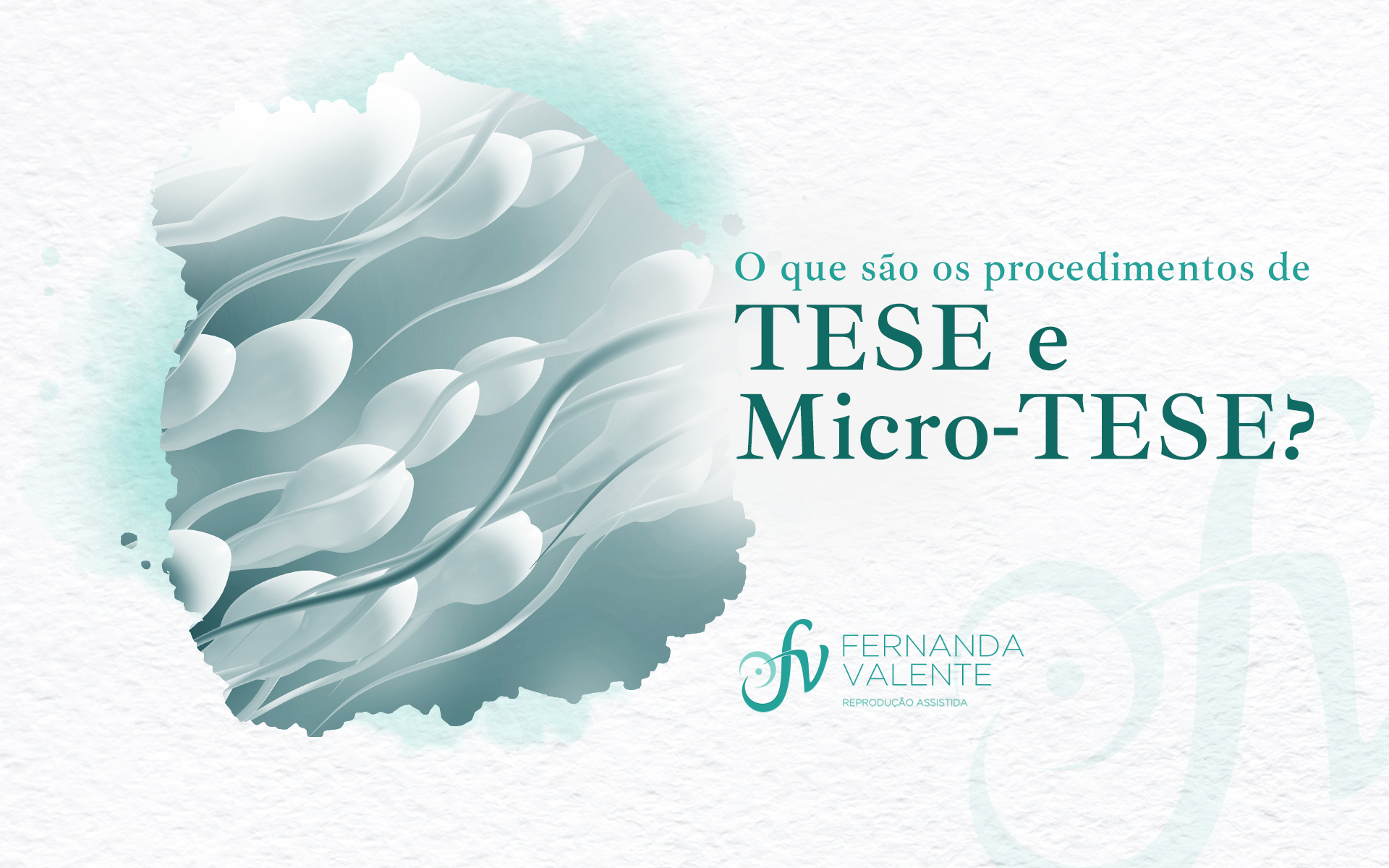 O que são os procedimentos de TESE e Micro-TESE? | Dra. Fernanda ...