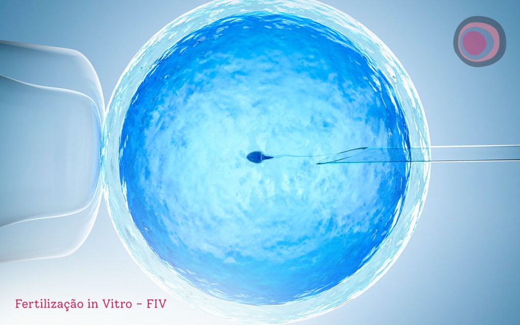 » Endometriose: qual o melhor tratamento e quando é indicada a ...