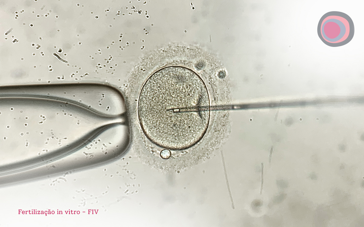 » Espermograma: saiba como é feita a análise do sêmen e dos espermatozoides